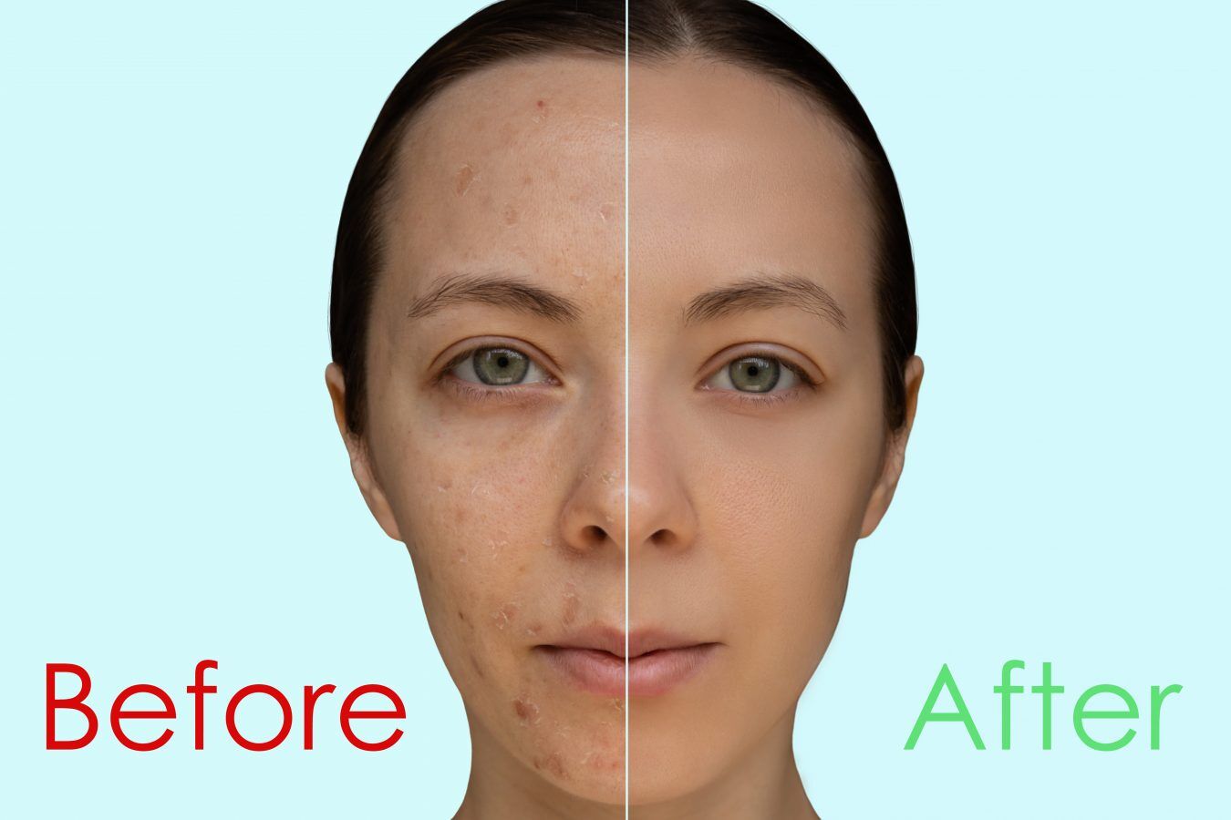 Custom Chemical Peels Dc Anewskin Aesthetic Clinic And Medical Spa
